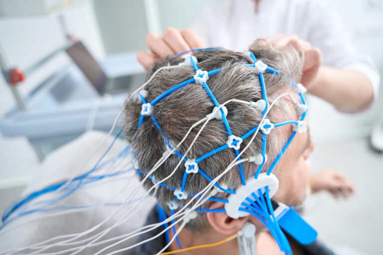 Why TMS Therapy Is Proven Safer Than At-Home Brain Stimulation for PTSD